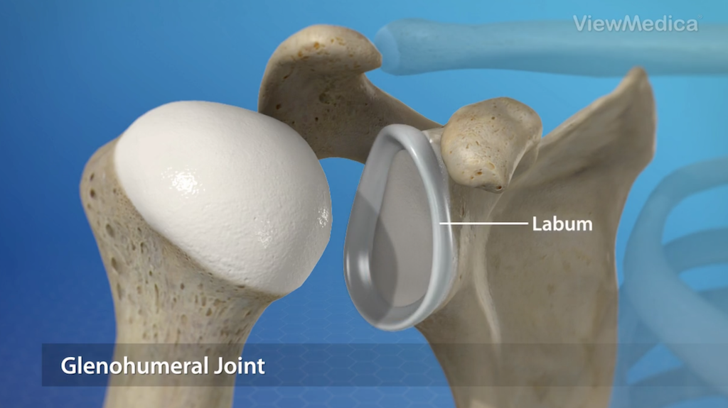 Shoulder Surgery, Shoulder Pain, Rotor Cuff, Frozen Shoulder